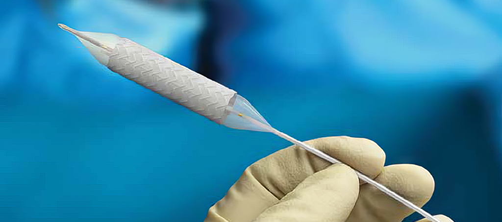 Atrium Advanta V12 Balloon Expandable Covered Stents – Lemare